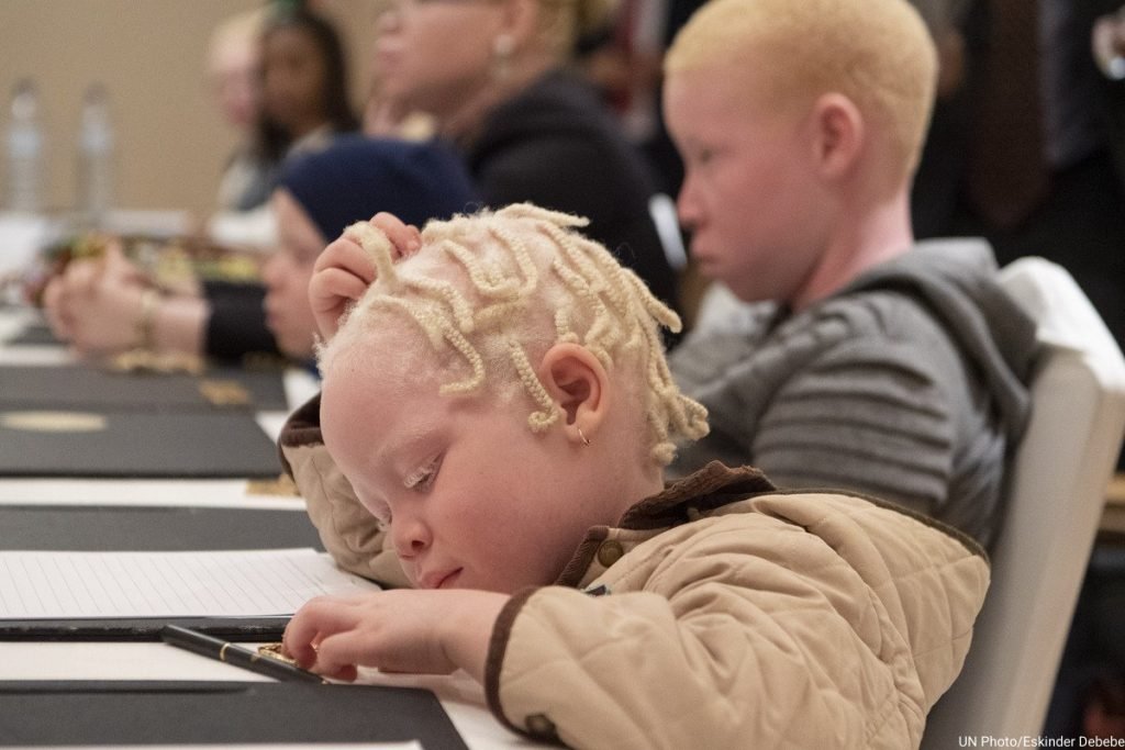 International Albinism Awareness Day